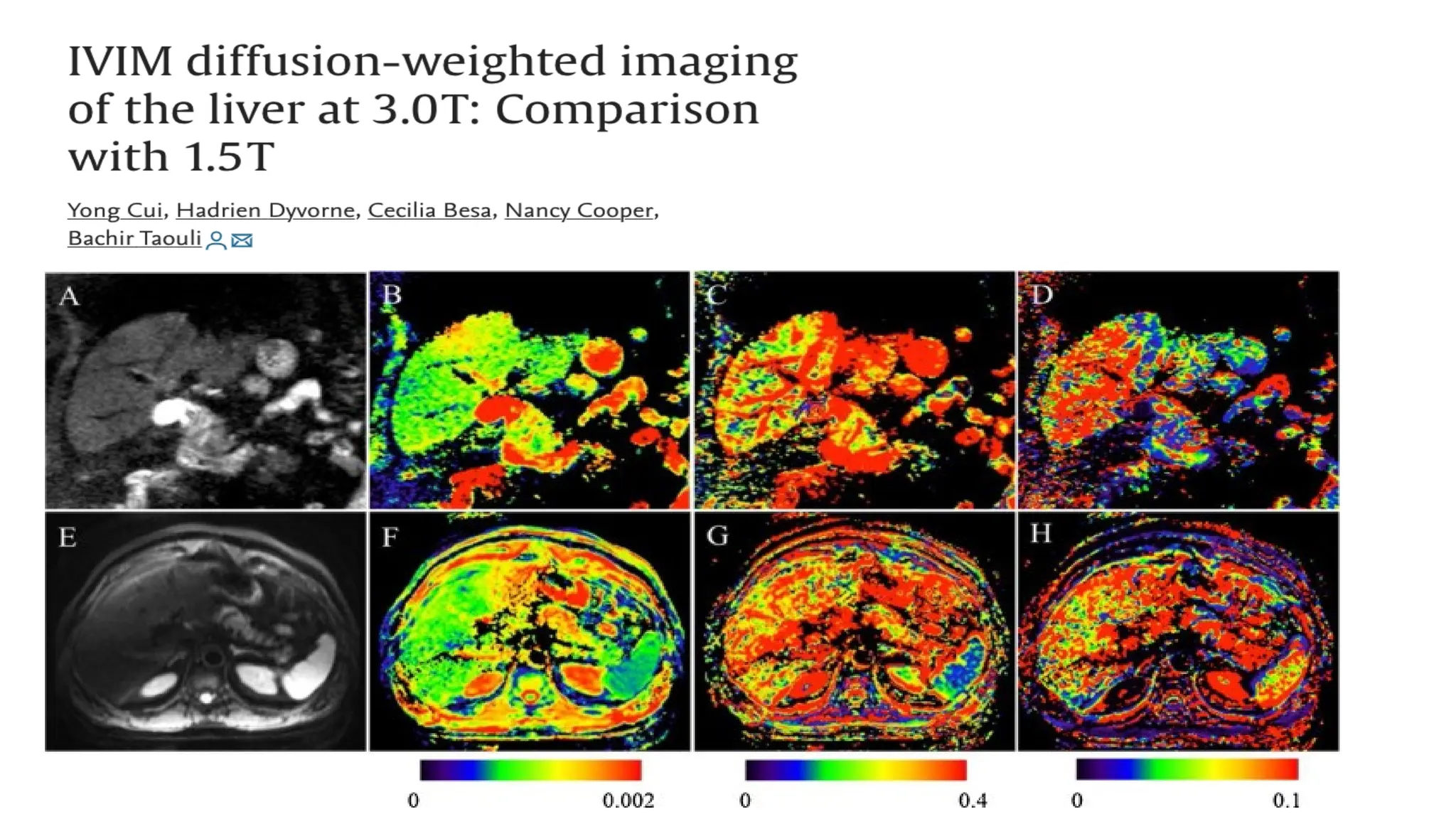 Diffusion Weighted MR from basic to advanced.pptx