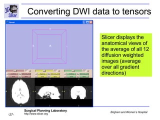Diffusion Tensor Imaging Analysis-3749 | PPT