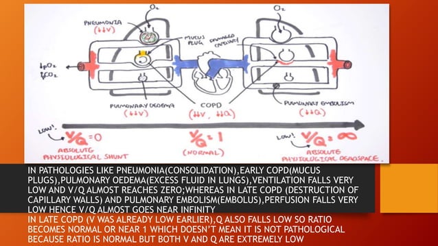 Diffusion across respiratory membrane ventilation perfusion ratio and ...