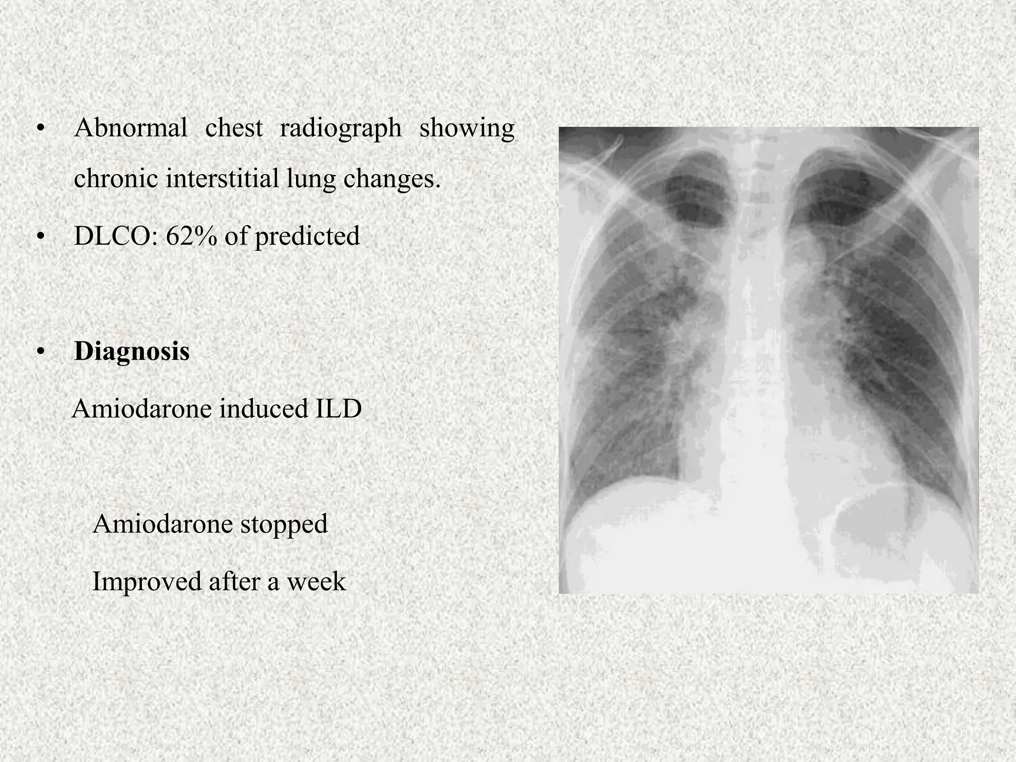 Diffusion Capacity: Indications and Interpretation | Jindal Chest ...