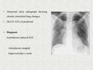 Diffusion Capacity: Indications and Interpretation | Jindal Chest ...