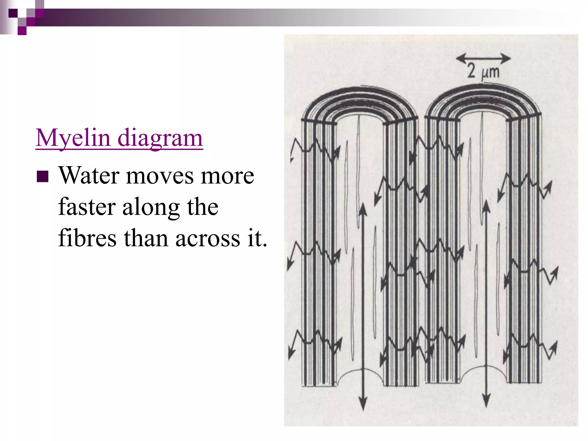 DIFFUSION & PERFUSION r MRI.ppt