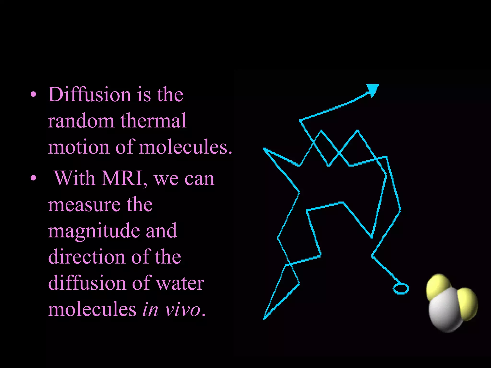 DIFFUSION & PERFUSION r MRI.ppt