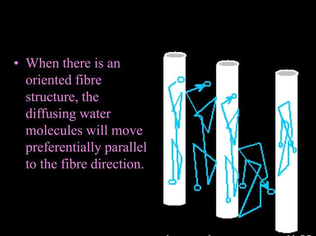 DIFFUSION & PERFUSION r MRI.ppt