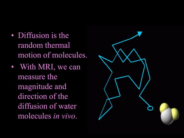 DIFFUSION & PERFUSION r MRI.ppt