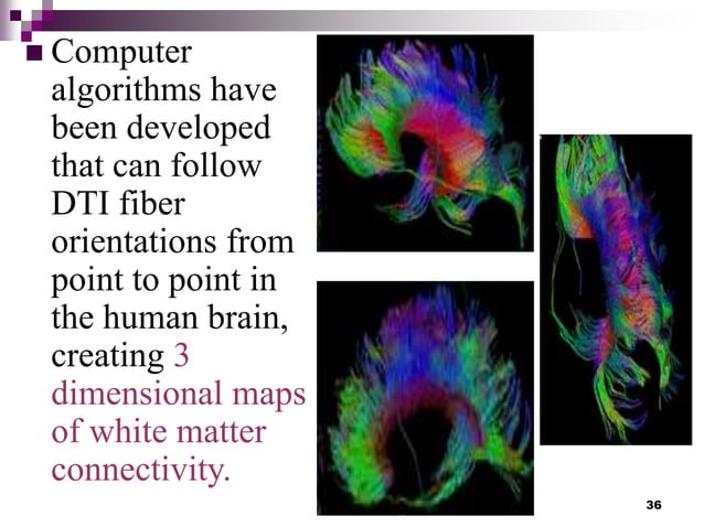 DIFFUSION & PERFUSION r MRI.ppt