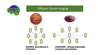 Diffusion tensor imaging in evaluation of epilepsy ppt.pptx