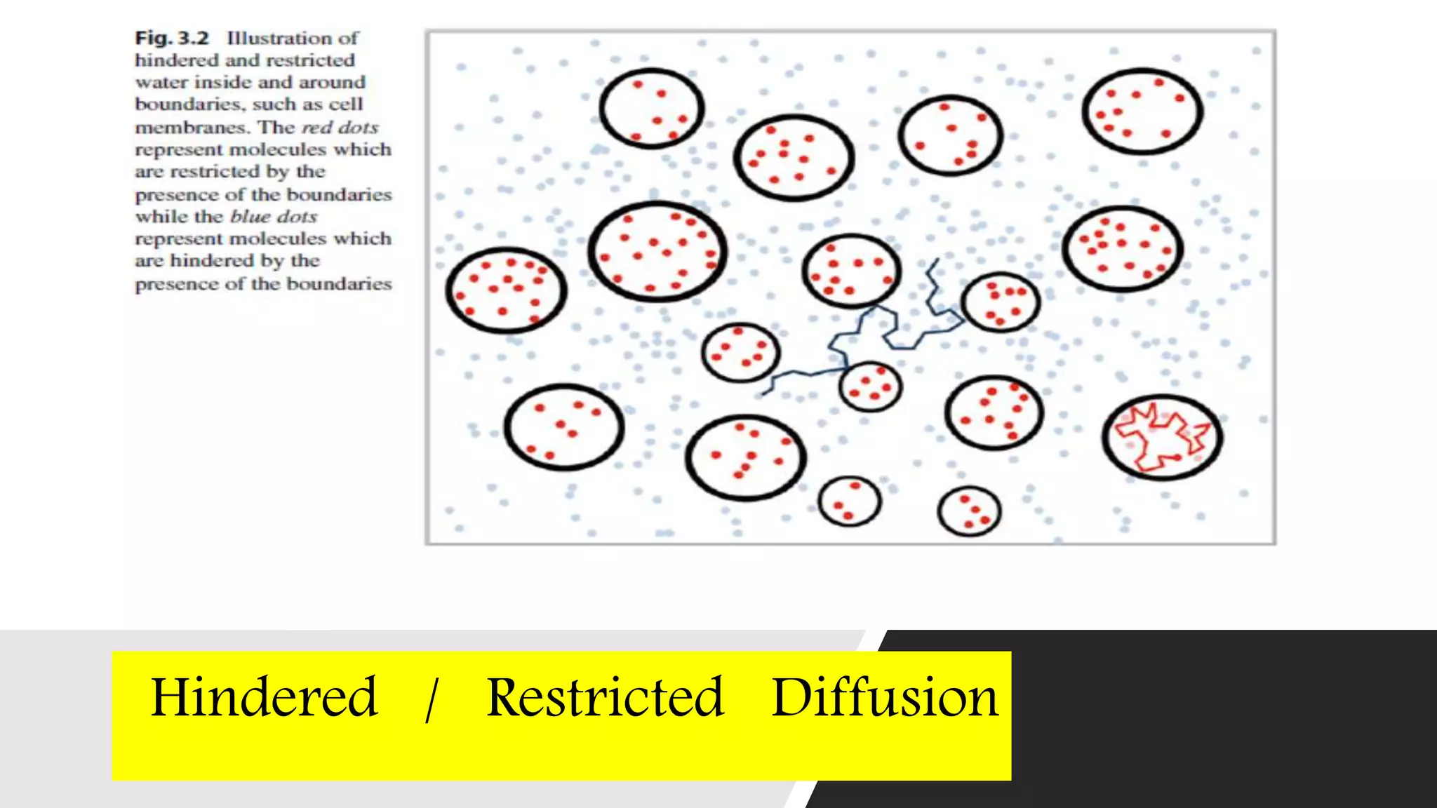 Diffusion tensor imaging in Neurology | PPTX