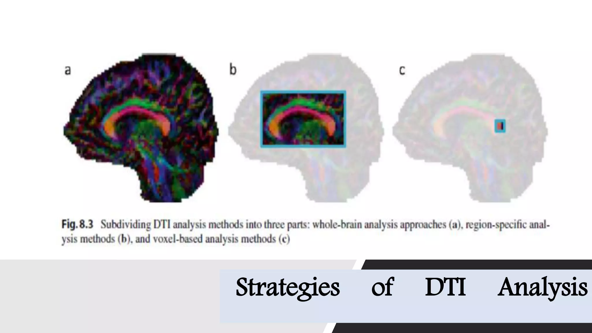 Diffusion tensor imaging in Neurology | PPTX