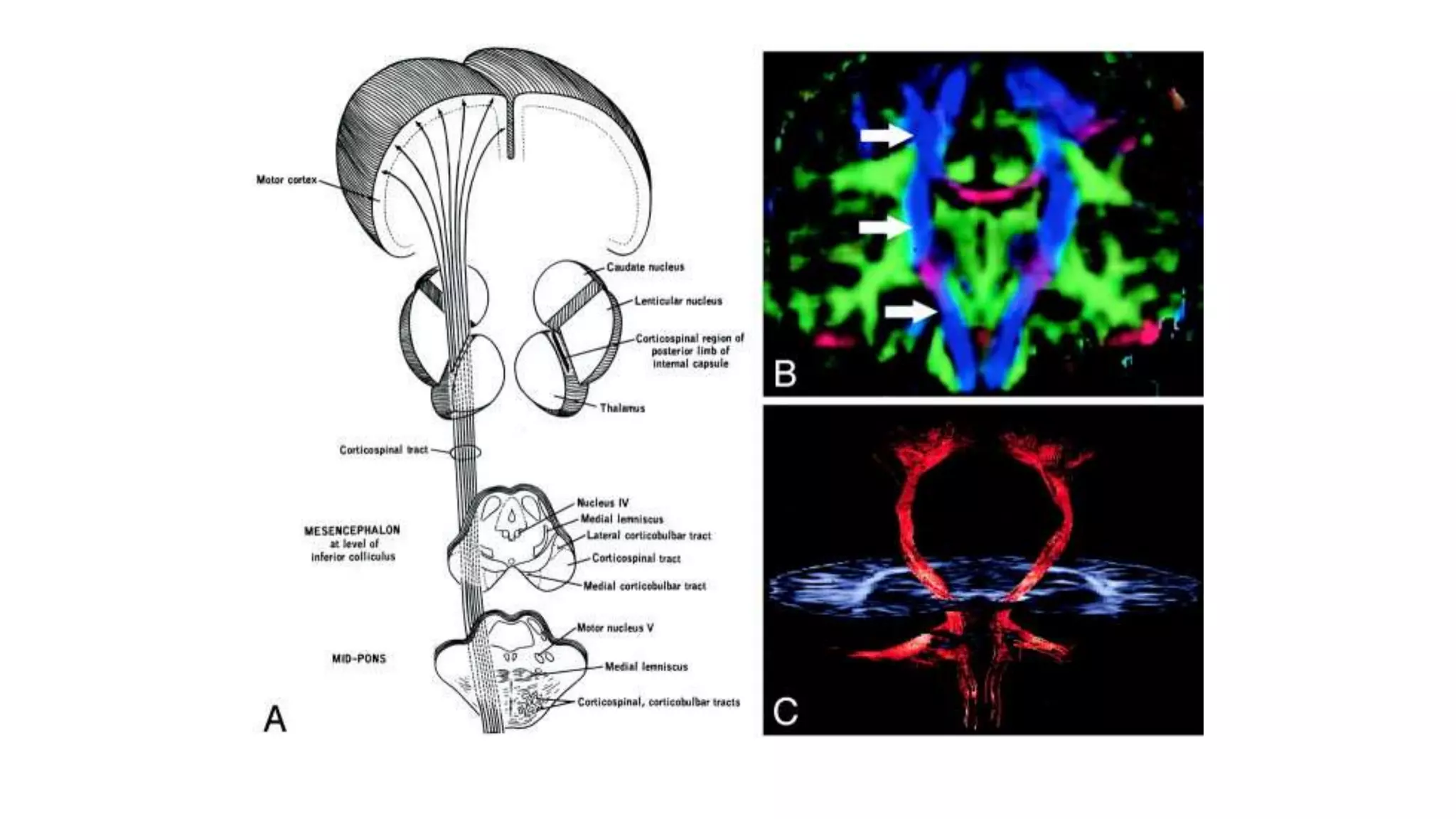 Diffusion Tensor Imaging Pptx