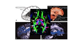 Diffusion tensor imaging .pptx
