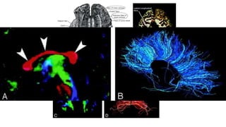 Diffusion tensor imaging .pptx
