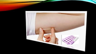 Diffusion theory finale | PPTX