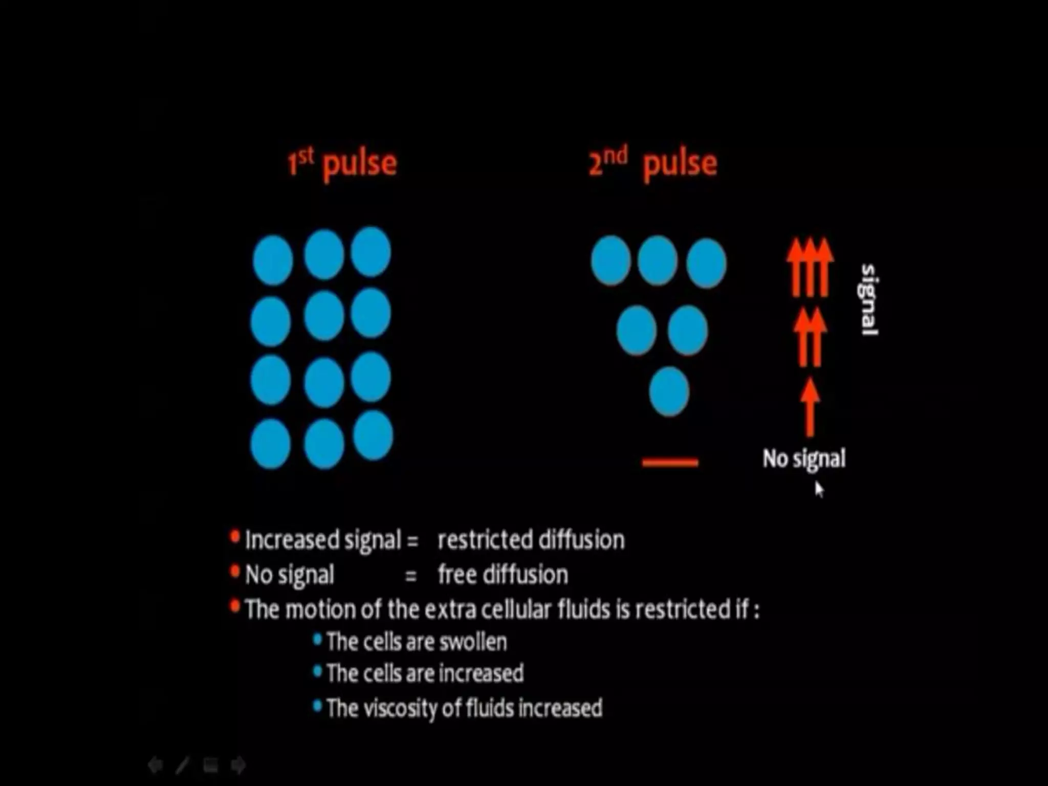 Diffusion weighted brain imaging | PPTX