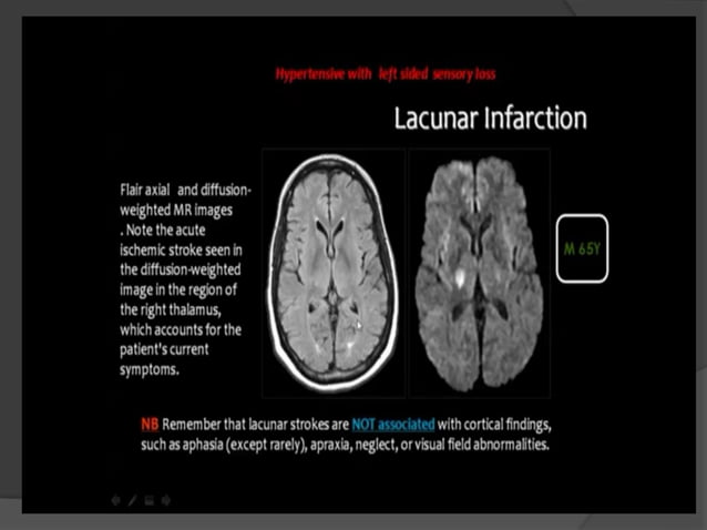 Diffusion weighted brain imaging | PPTX