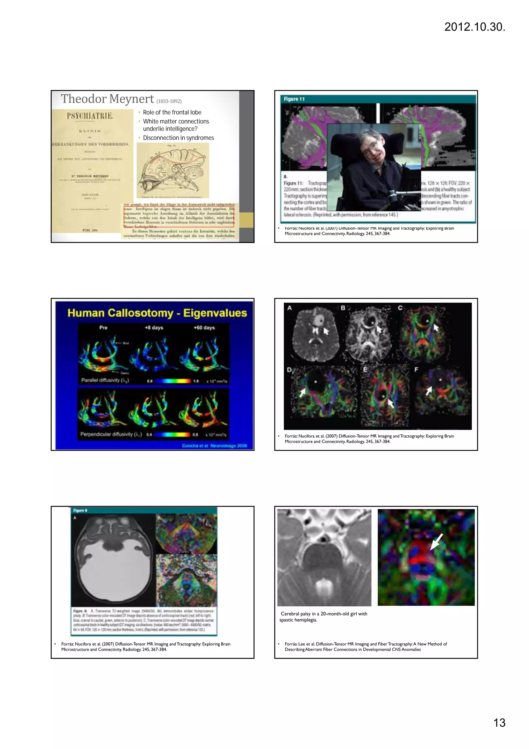 Week 2. Diffusion magnetic resonance imaging, tractography, mapping the ...