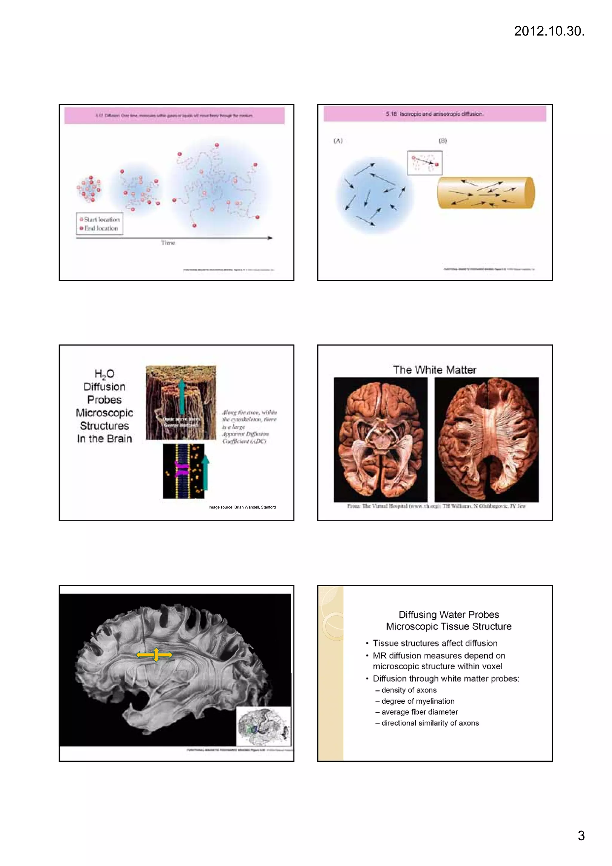 Week 2. Diffusion magnetic resonance imaging, tractography, mapping the brain's connectome ...