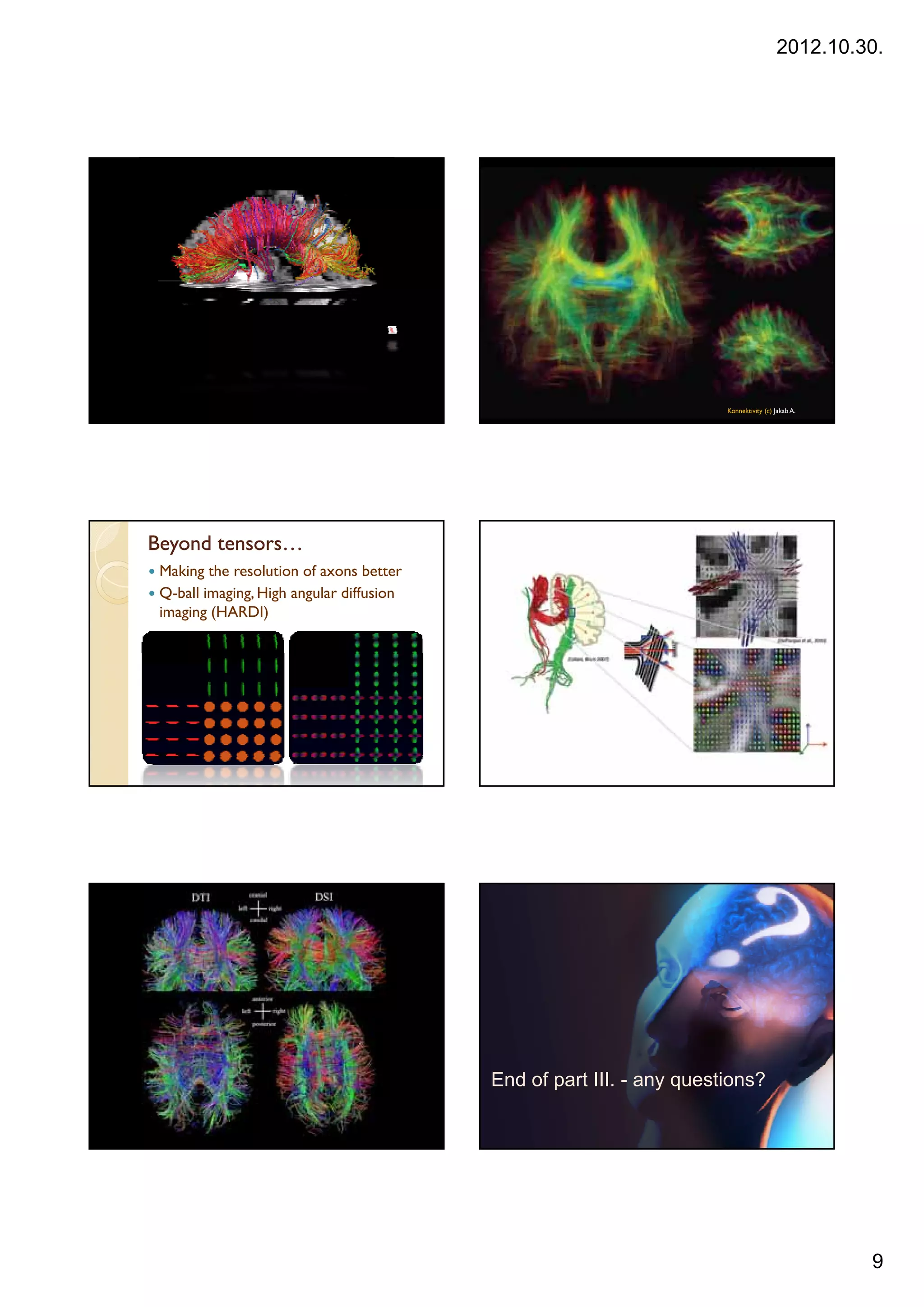Week 2. Diffusion magnetic resonance imaging, tractography, mapping the ...