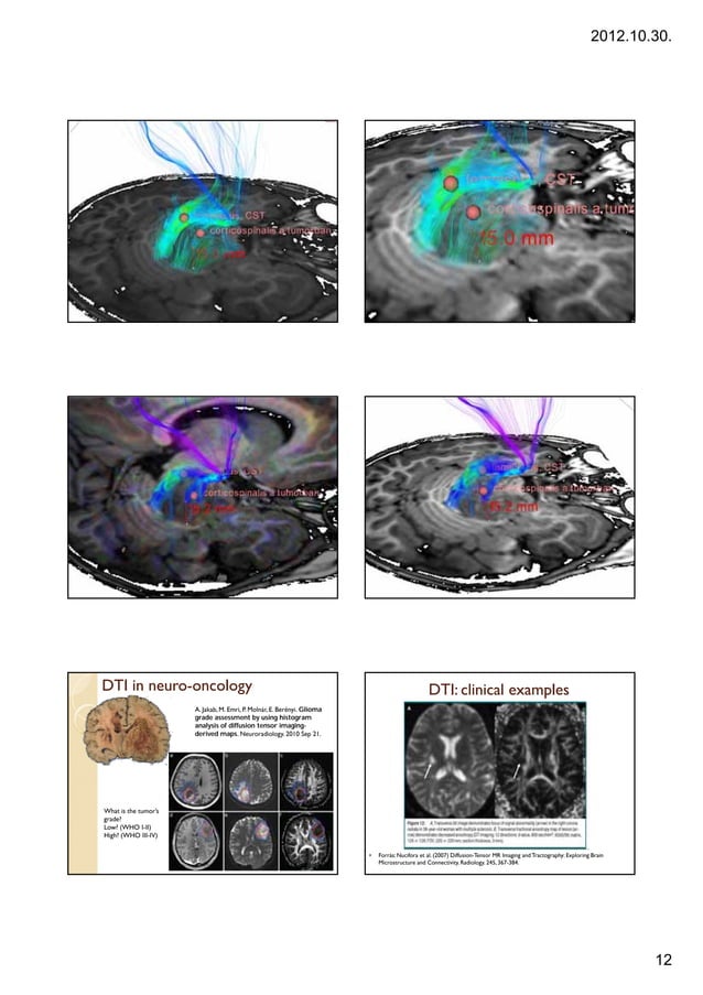 Week 2. Diffusion magnetic resonance imaging, tractography, mapping the ...