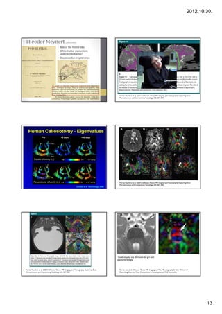Week 2. Diffusion magnetic resonance imaging, tractography, mapping the ...