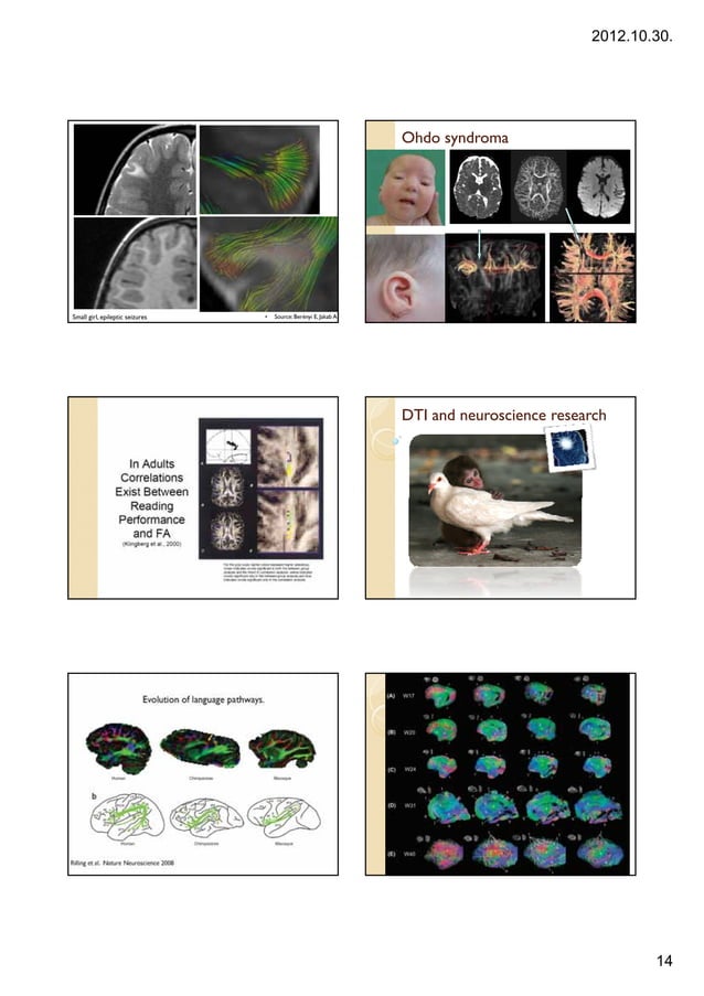 Week 2. Diffusion magnetic resonance imaging, tractography, mapping the brain's connectome ...