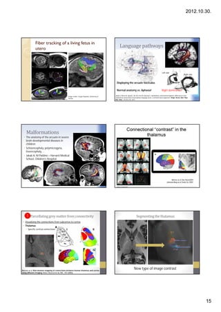 Week 2. Diffusion magnetic resonance imaging, tractography, mapping the ...