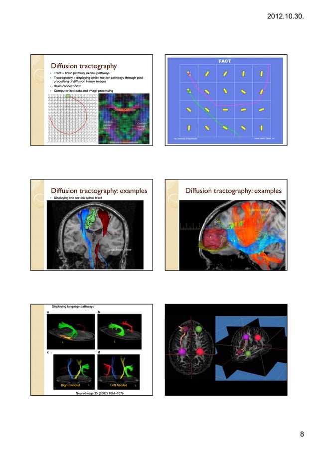 Week 2. Diffusion magnetic resonance imaging, tractography, mapping the brain's connectome ...