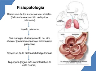 dificiltad respiratoria en pediatría.pptx