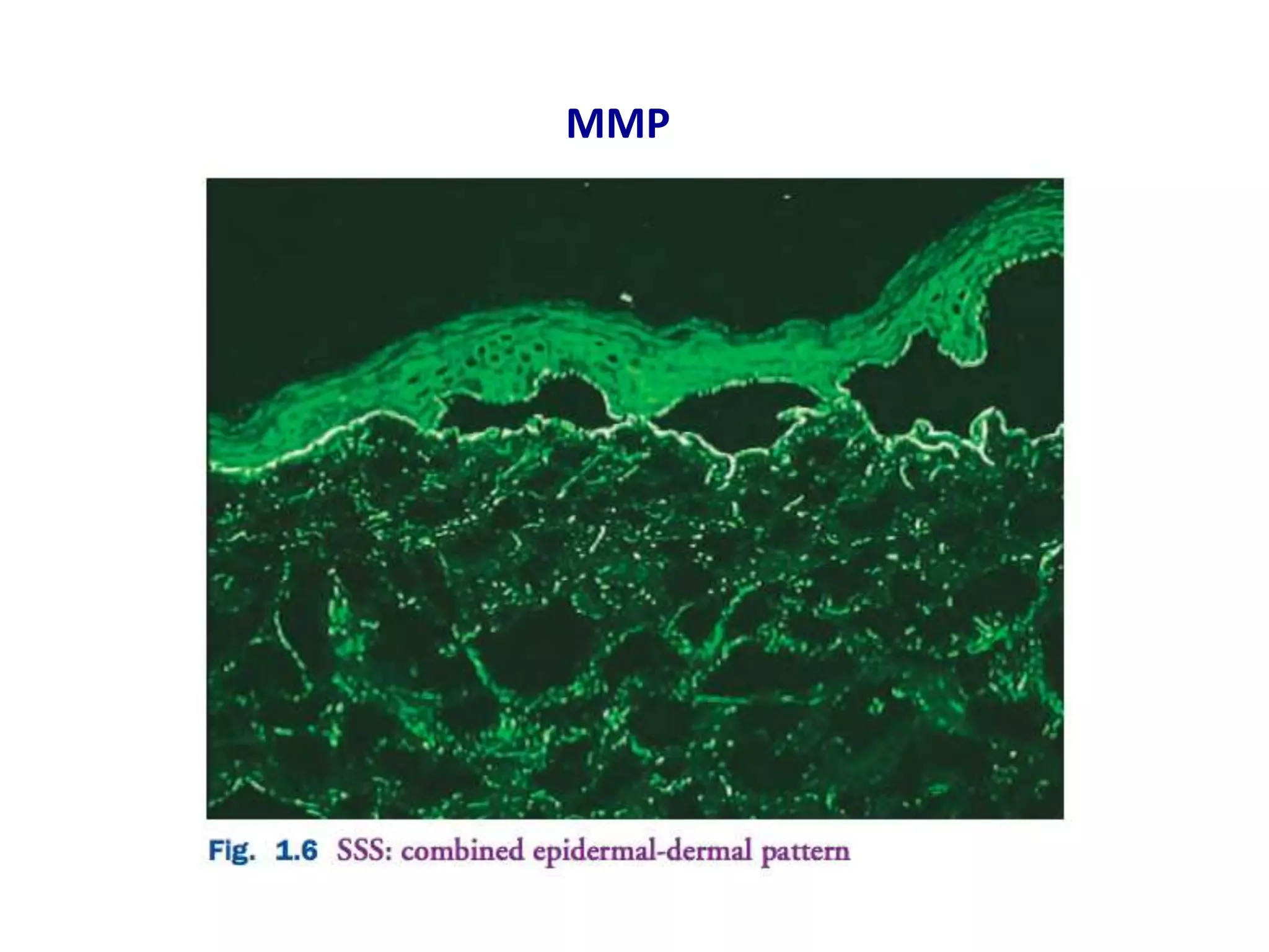 Direct Immunofluorescence in Dermatology | PPTX