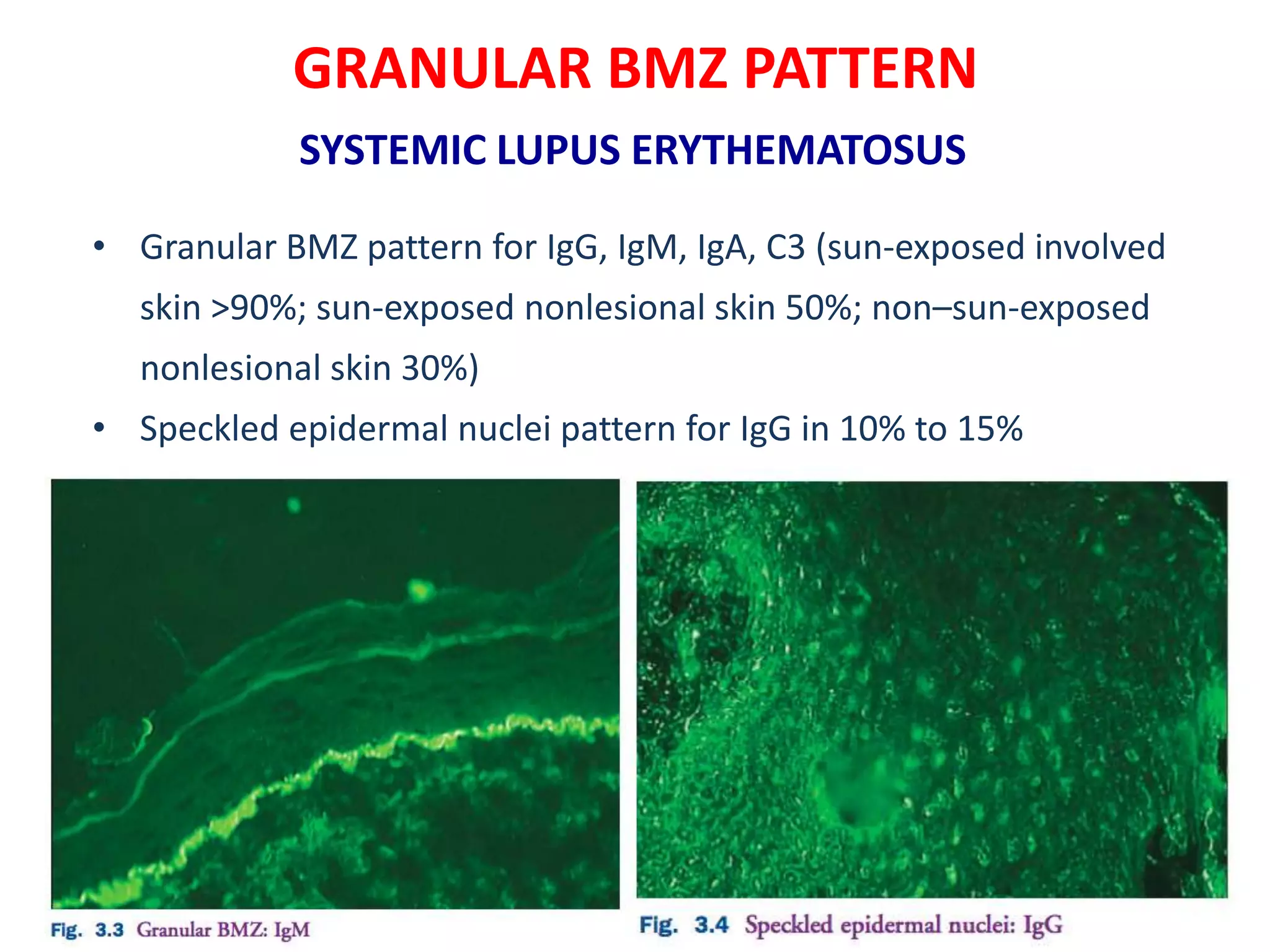Direct Immunofluorescence in Dermatology | PPTX
