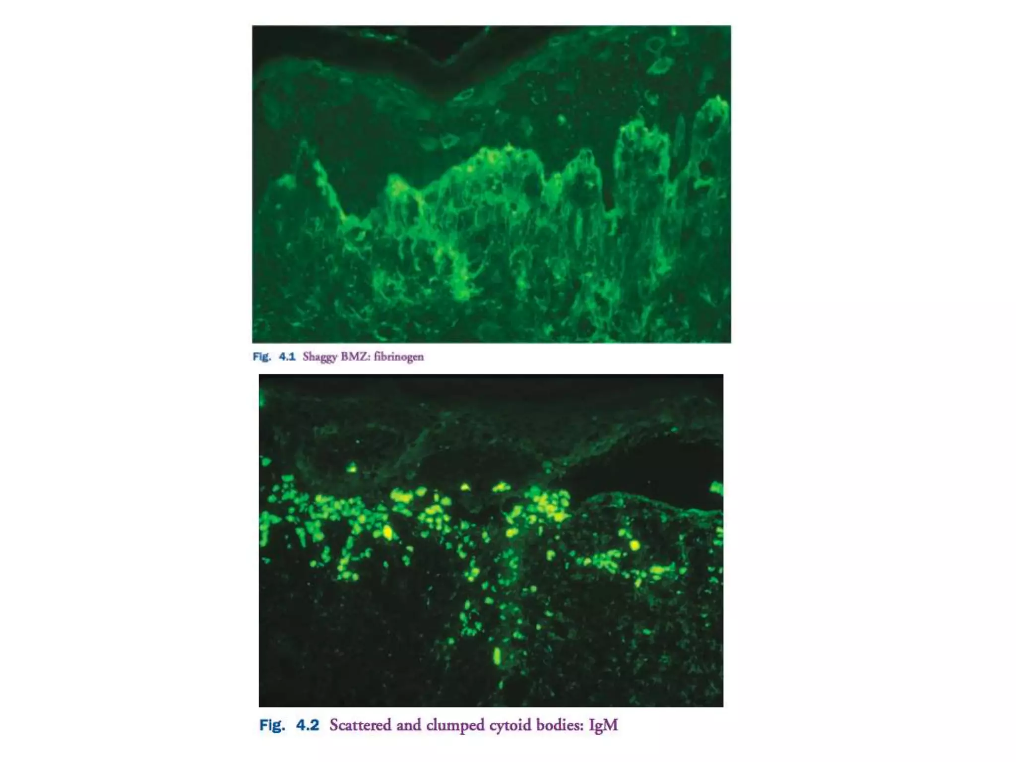 Direct Immunofluorescence in Dermatology | PPTX
