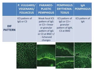 Direct Immunofluorescence in Dermatology | PPTX