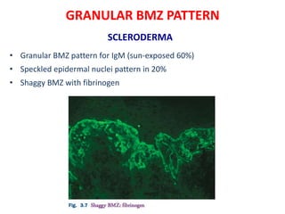 Direct Immunofluorescence in Dermatology | PPTX