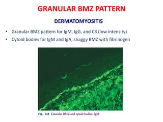 Direct Immunofluorescence in Dermatology | PPTX