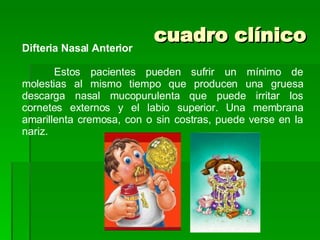 Difteria | PPT