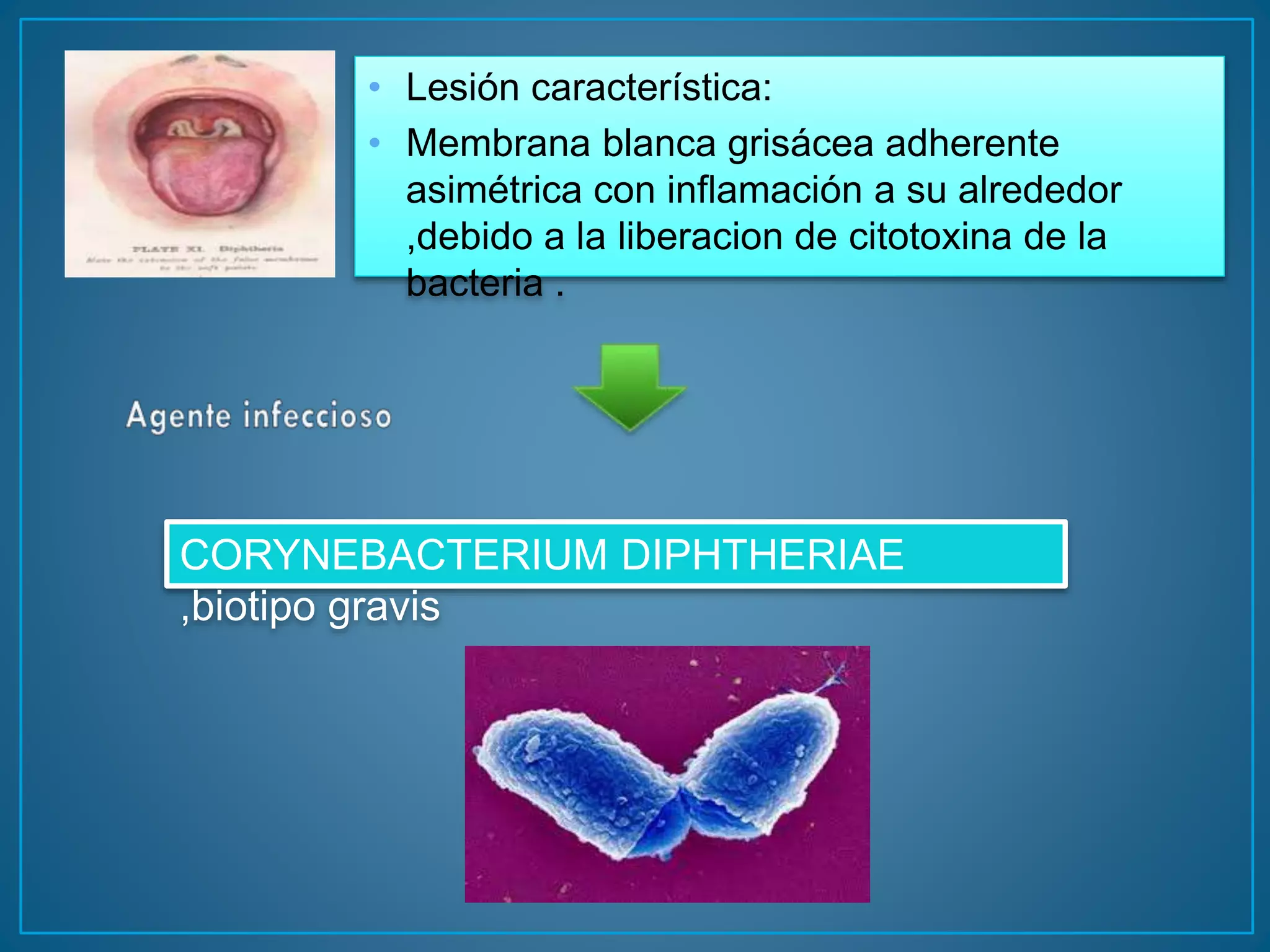 Difteria desde el punto de vista epidemiologico | PPT