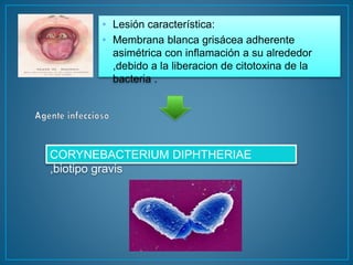 Difteria desde el punto de vista epidemiologico | PPTX