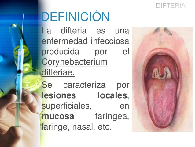 Difteria