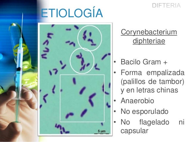 Difteria