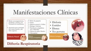 Difteria | PPTX