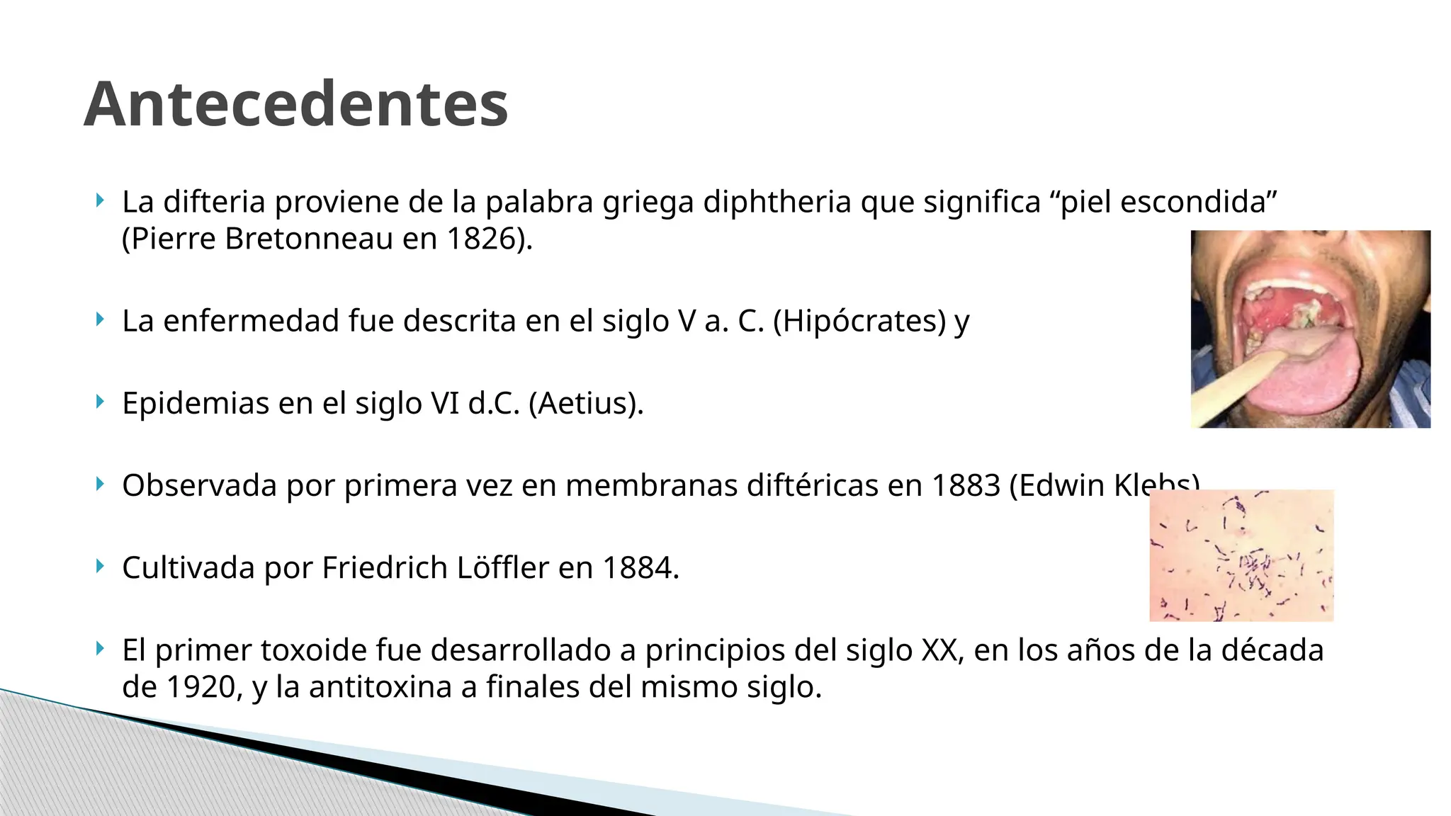 Enfermedad por Difteria_signos, sintomas y dx.pptx