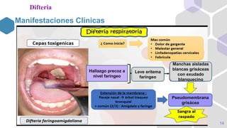 DIFTERIA .pptx