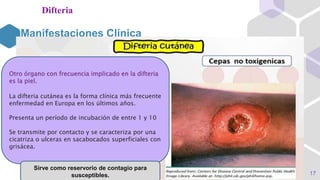 DIFTERIA .pptx