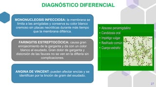 DIFTERIA .pptx