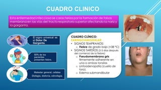 DIFTERIA .pptx