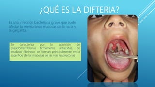 DIFTERIA .pptx