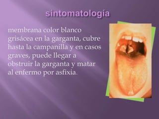 Difteria diapo | PPTX