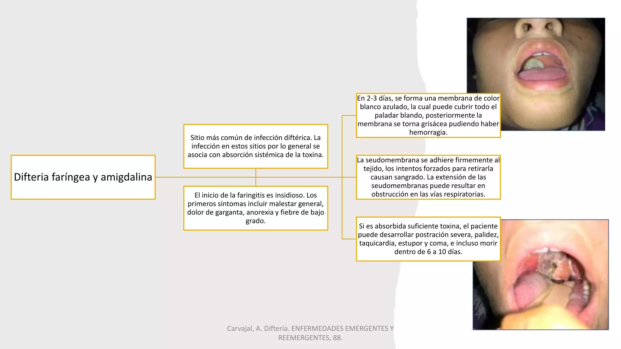Difteria y Tos ferina.pptx