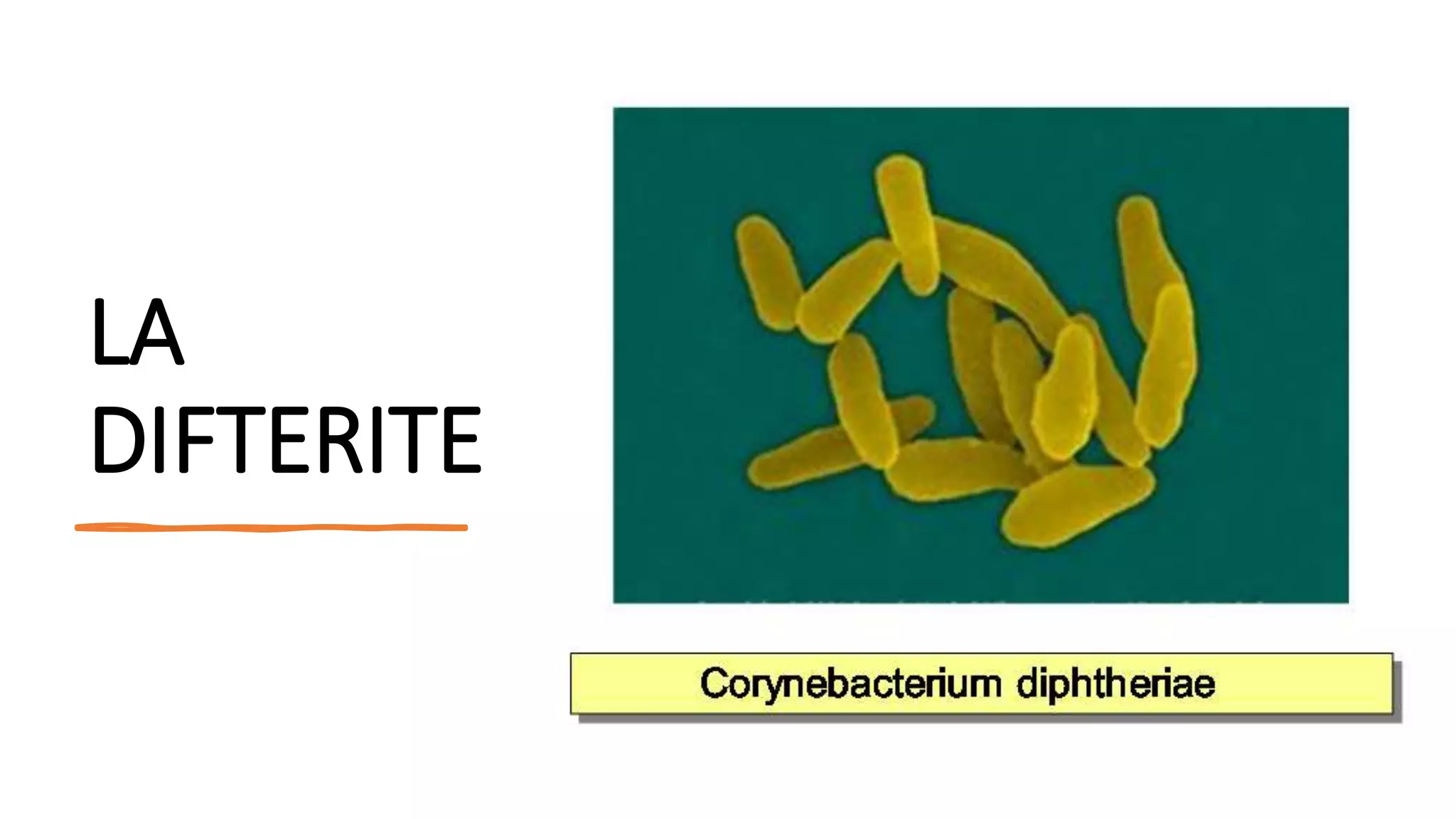 DIFTERITE Stefano Dell'Elce.pptx