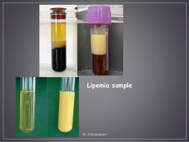 Dig and abs of lipids